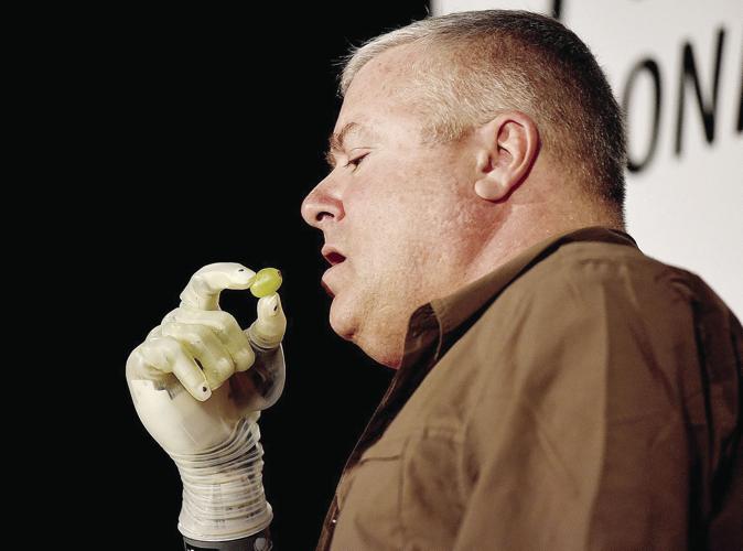 Bionic technology gives amputees more natural control over hand, arm ...