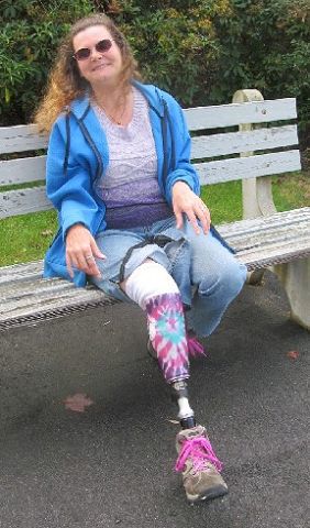 Portsmouth woman back in step thanks to her new bionic foot | Health ...