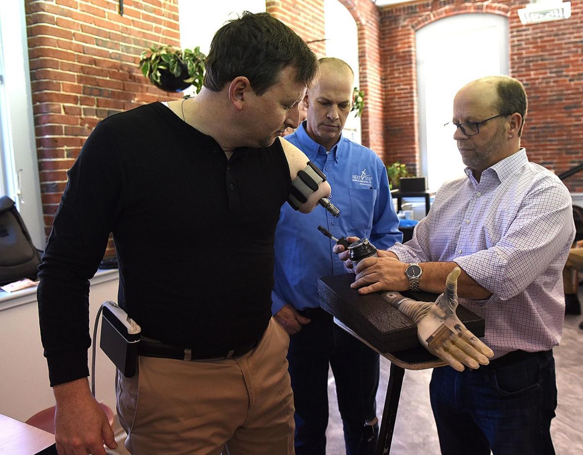 Luke arm and special surgery gives amputees better movement | Science ...