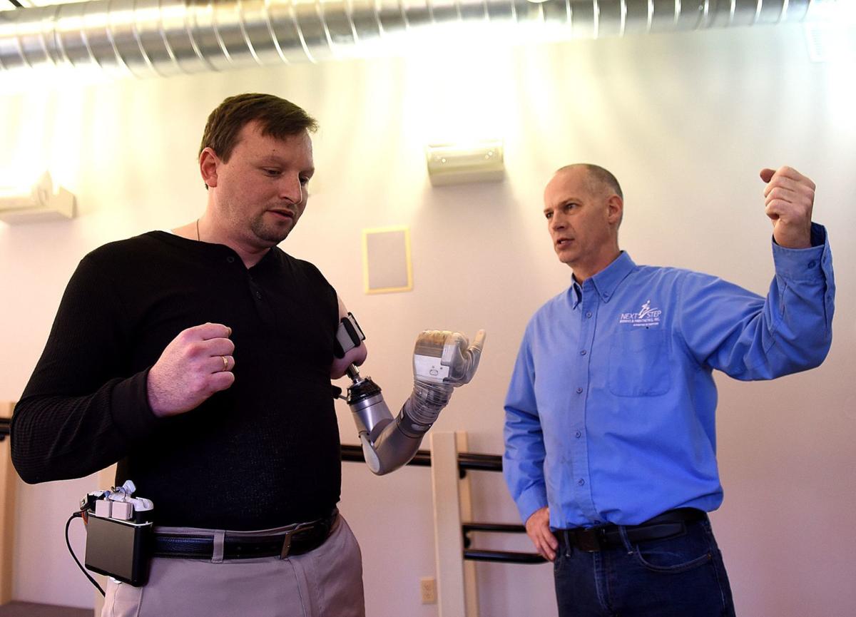 Luke arm and special surgery gives amputees better movement | Science ...