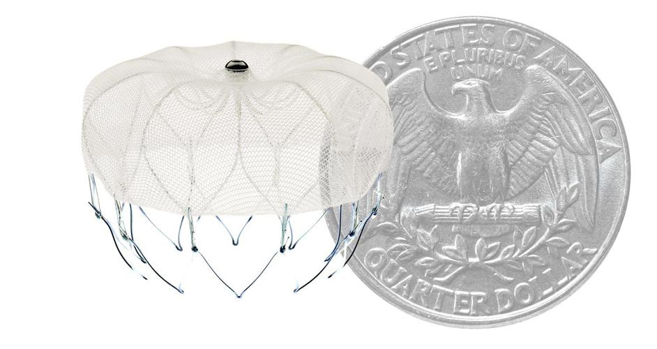 CMC offers WATCHMAN Implant for A-Fib patients | Health | unionleader.com