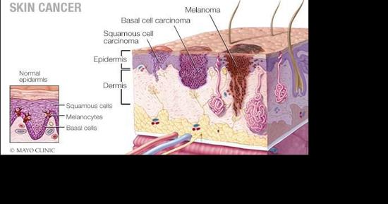basal cell layer