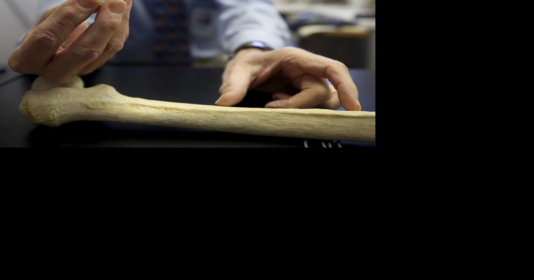 Arizona team studying bone regrowth earns $2M military grant | Ap ...