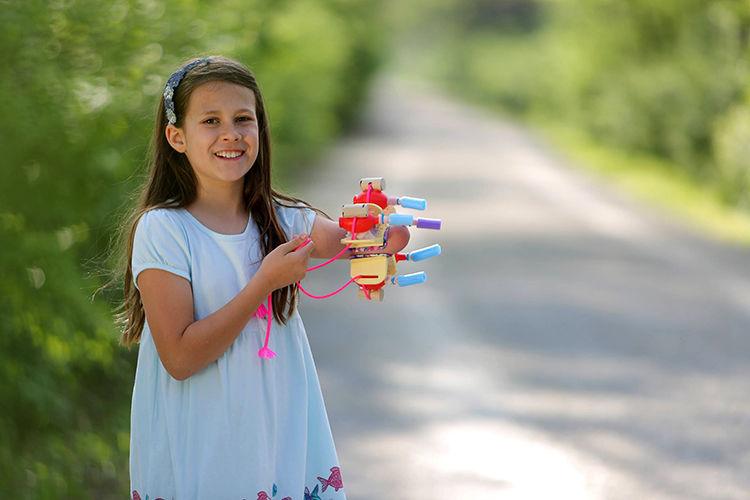 10-year-old Jordan Reeves hopes to normalize limb difference | People ...