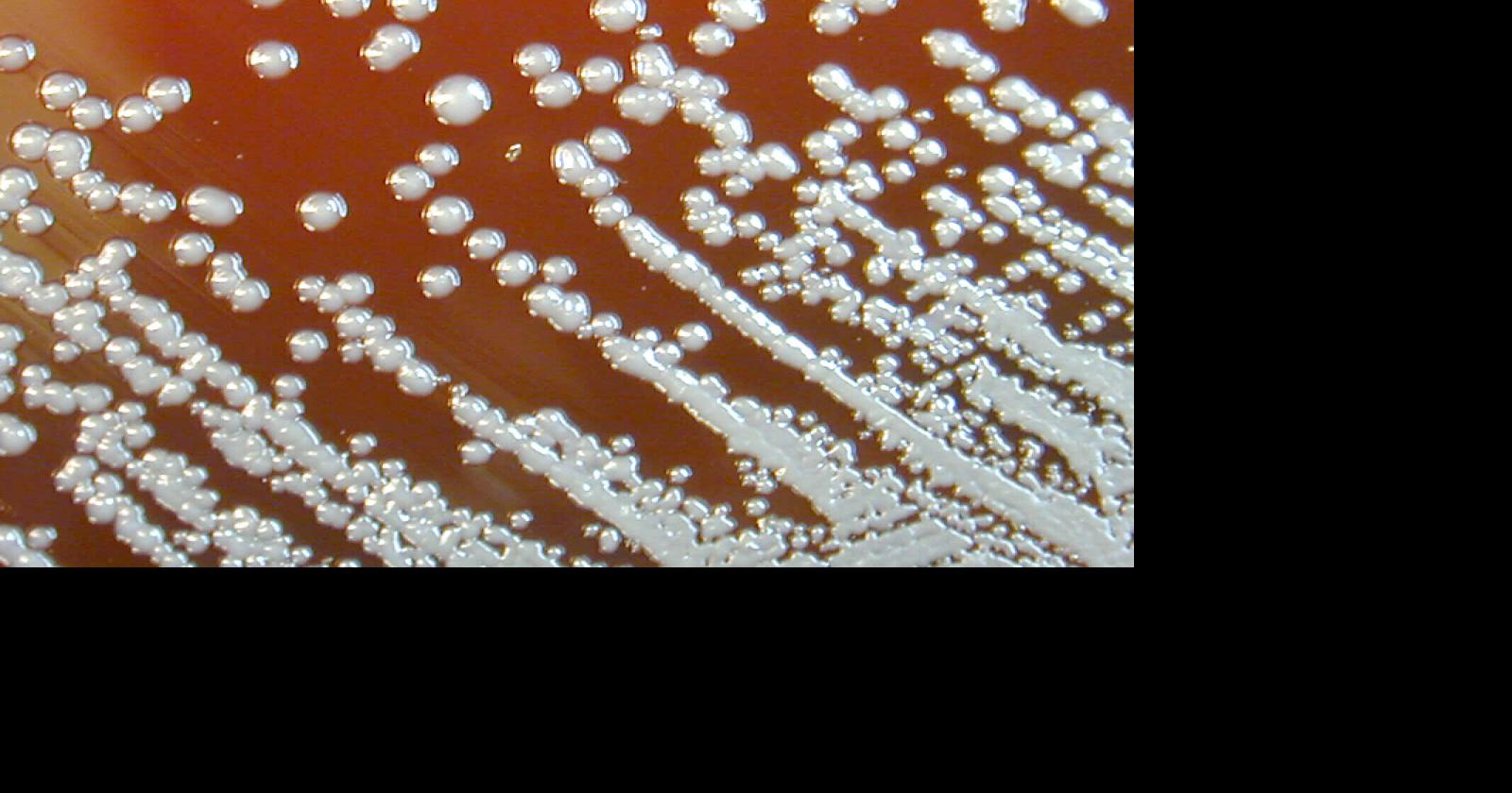 Bacteria that causes rare, serious illness is endemic in parts of ...