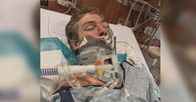 Family of injured Deshler football player releases statement after no ...