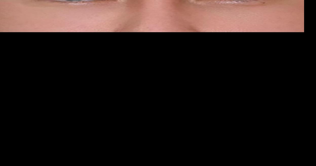 A quick surgical procedure can permanently change your eye color, but ...
