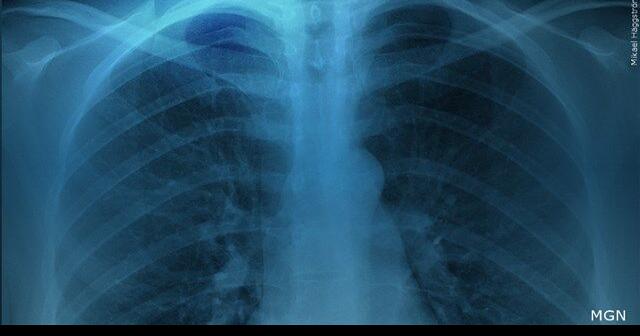 Doctors preparing for fall respiratory illness season in North Alabama ...