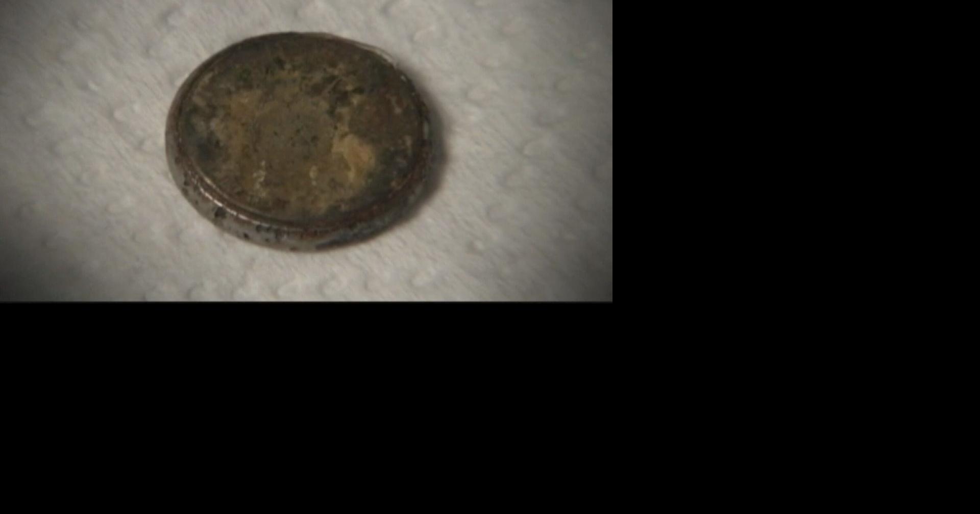Local doctors warn of button battery dangers | News | wandtv.com