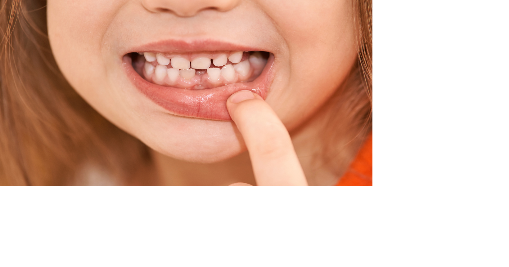 Tooth Fairy Can't Escape Inflation – Here's What the Average Value of a ...