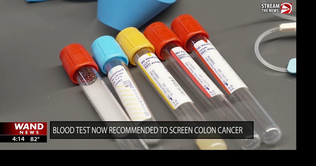 Blood test now recommended to screen colon cancer | Videos | wandtv.com
