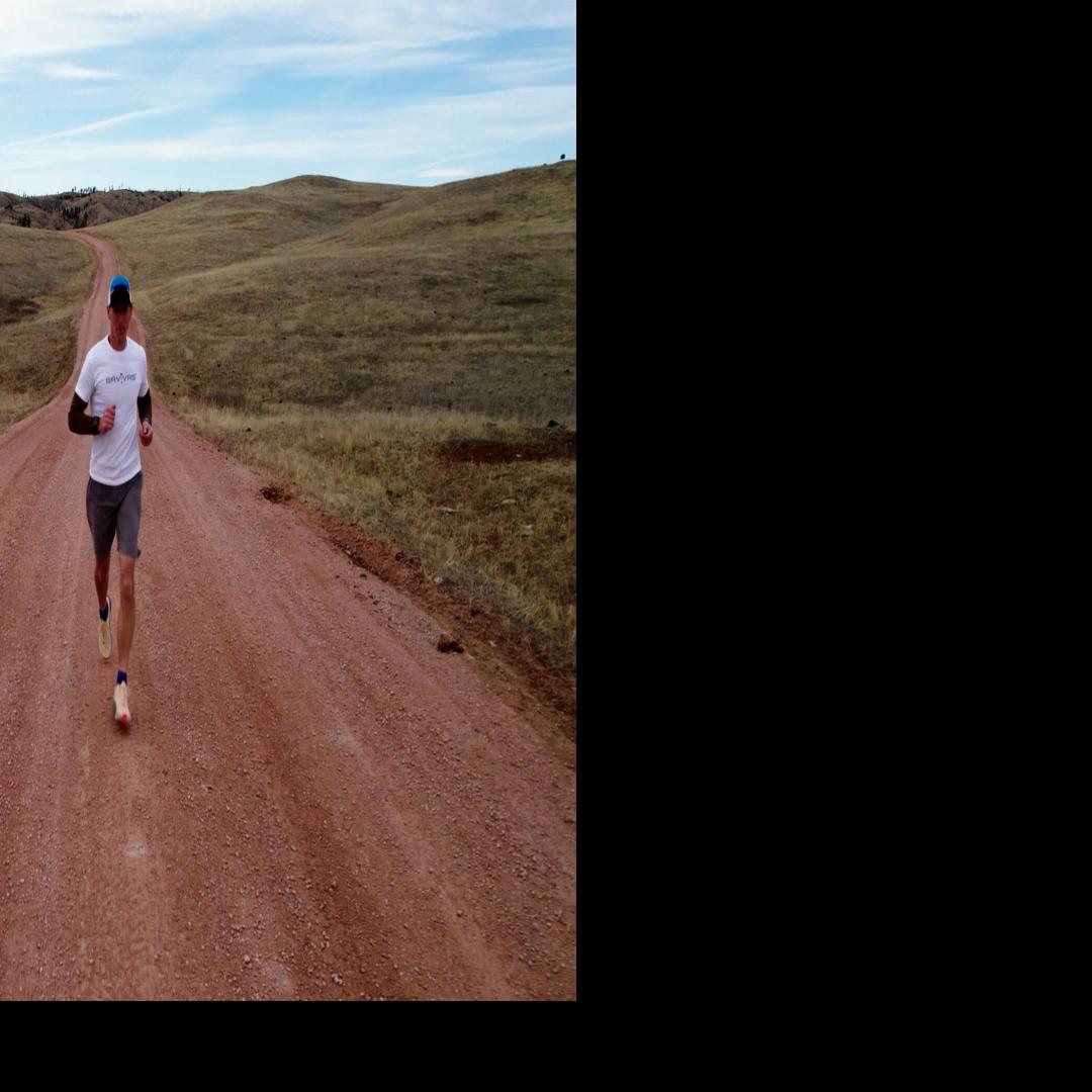 Bionic 'Ability Hand' gives amputees their touch back | Top Stories ...