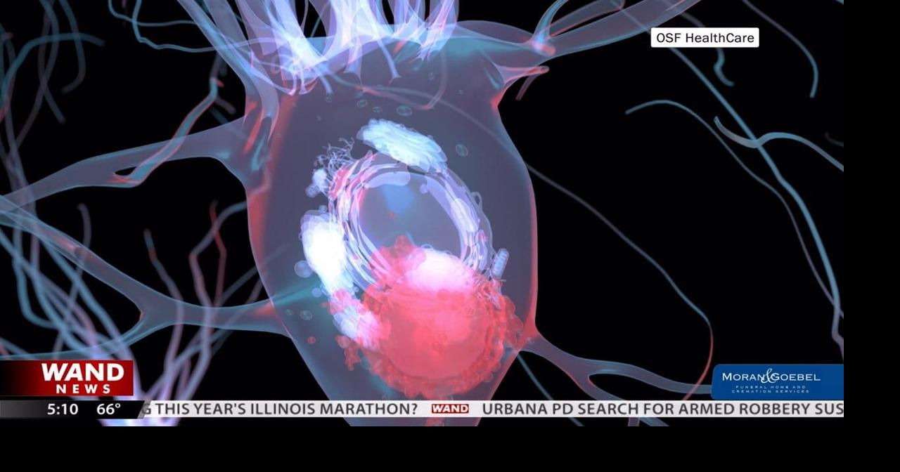 Lewy body dementia one of the most common types of dementia | Videos ...