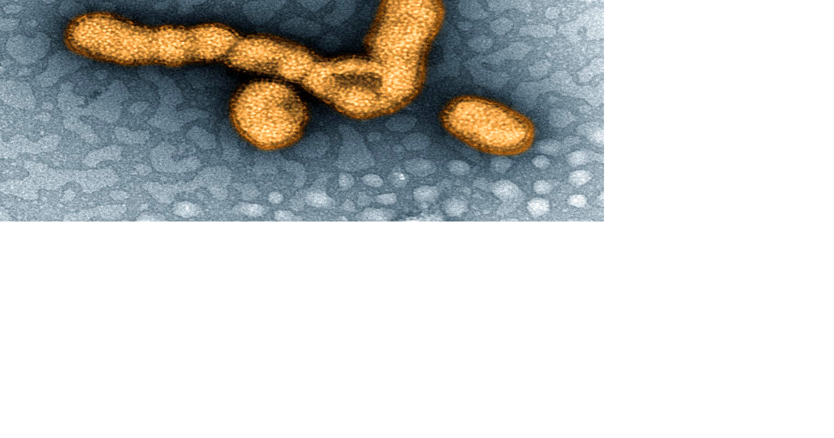 Tracking Wisconsin respiratory illnesses | News | waow.com