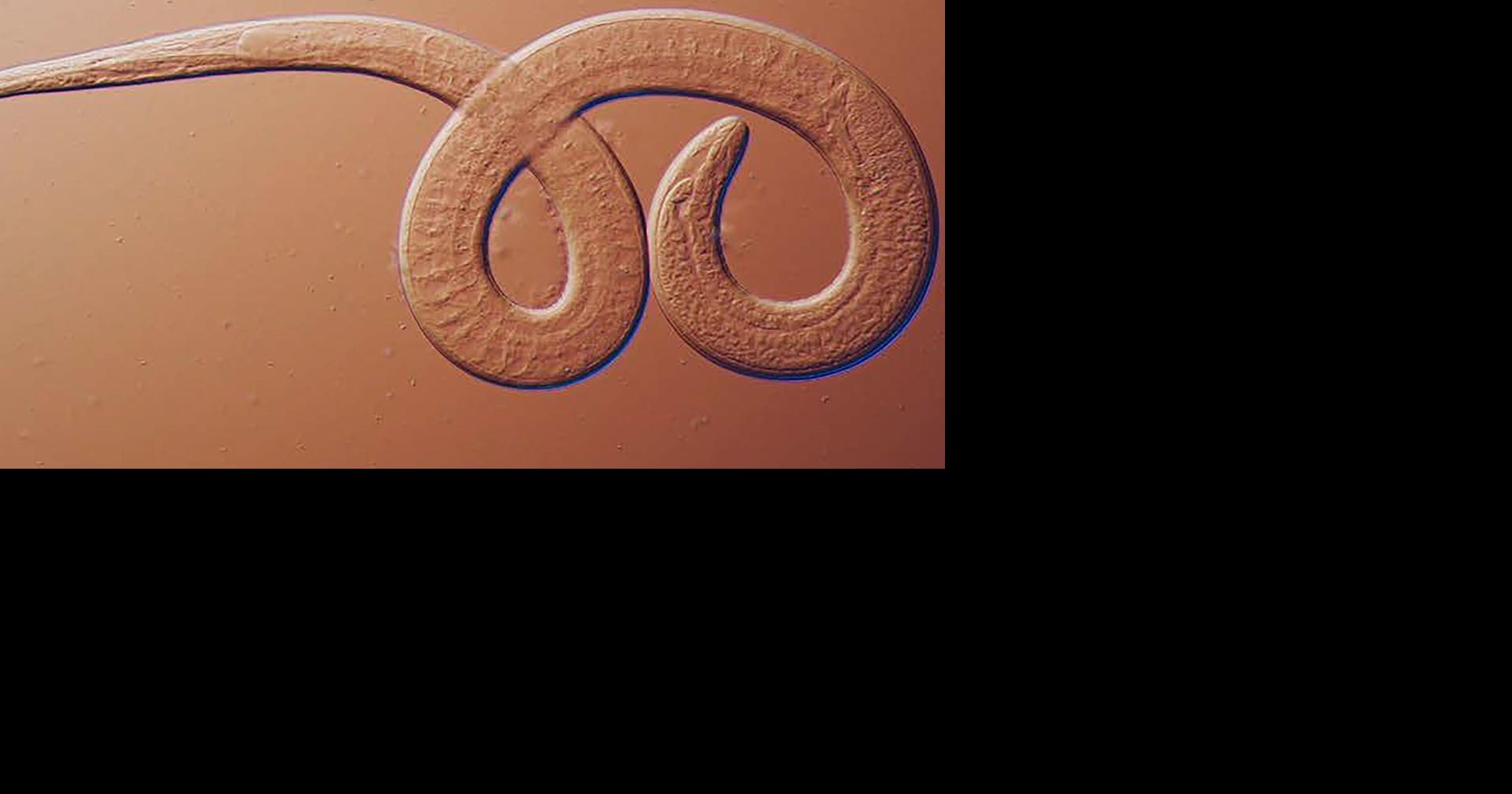 Black bear kebabs make family sick with parasitic worms | Health | waow.com