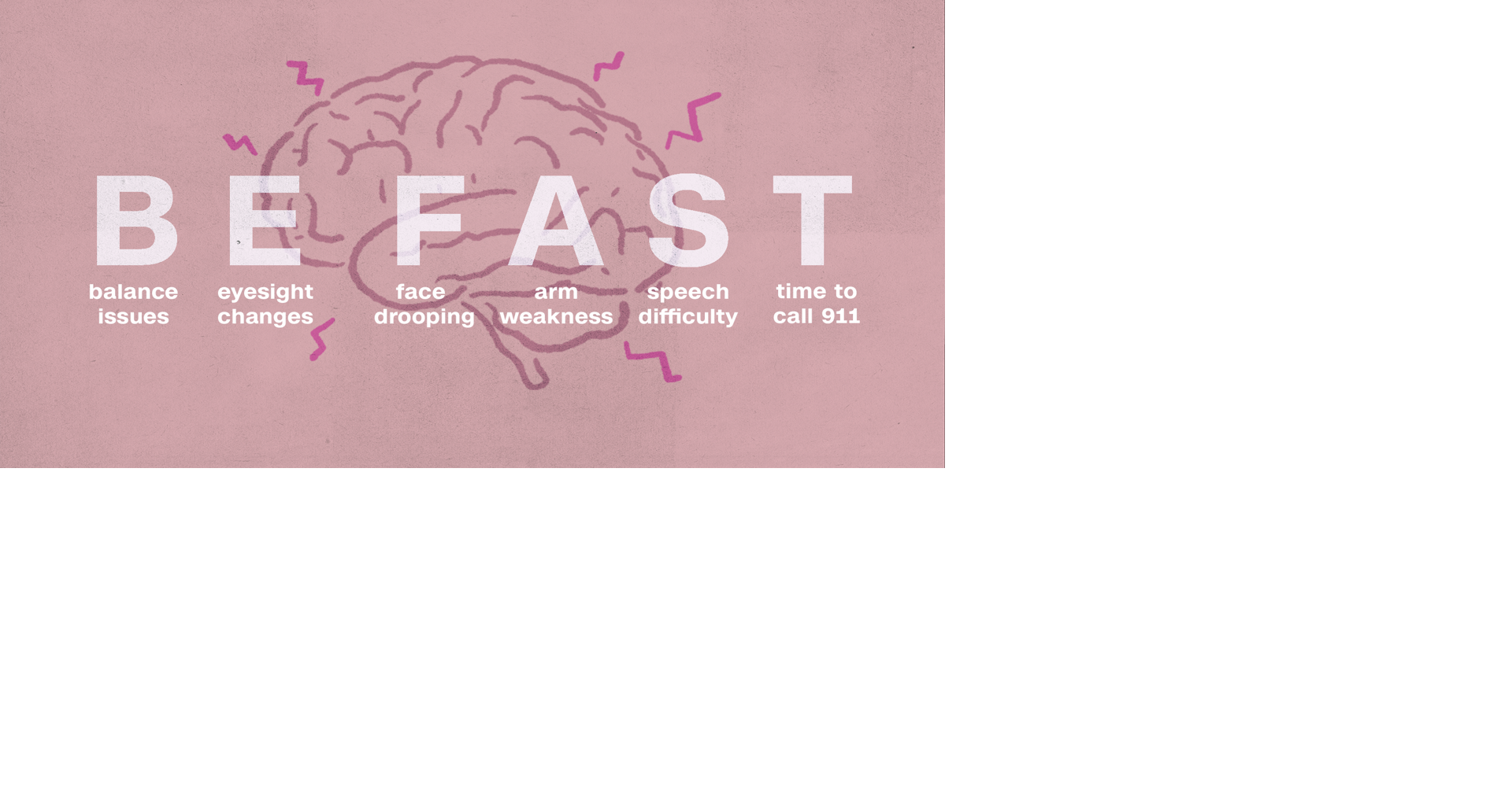 How to recognize signs of a stroke with the acronym BE FAST | News ...