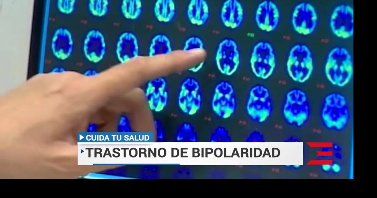 ¿Qué es la bipolaridad y cómo tratarla? | Salud | wapa.tv