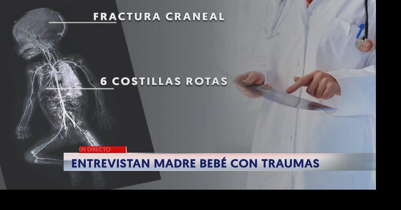 Oficiales entrevistan a padres de bebé con fracturas en las costillas y ...