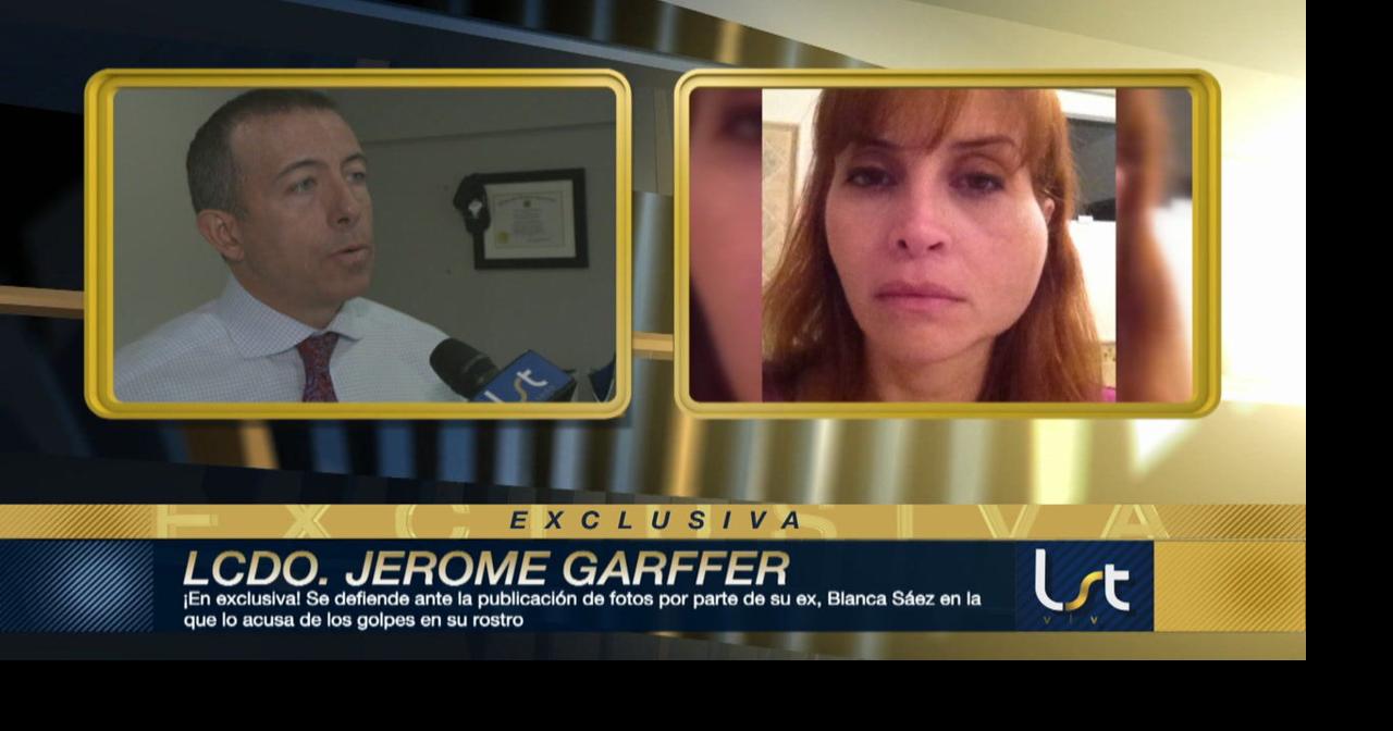Lcdo. Jerome Garffer habla en exlcusiva | Lo Sé Todo | wapa.tv