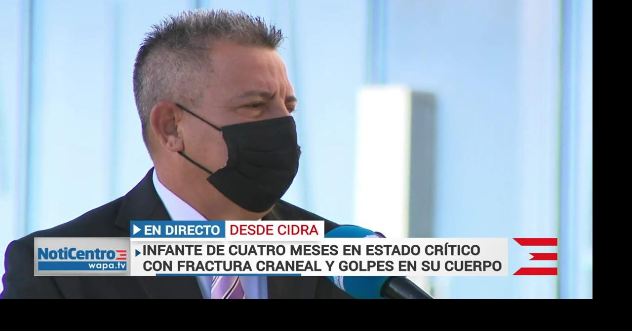 Investigan caso de infante de 4 meses con fractura craneal y golpes en Cidra | Última Hora | wapa.tv