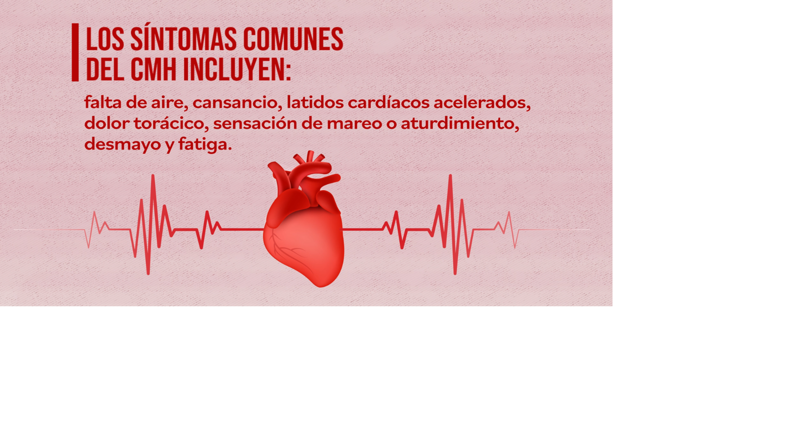 Síntomas y tratamientos de la Cardiomiopatía Hipertrófica | Camyzos ...