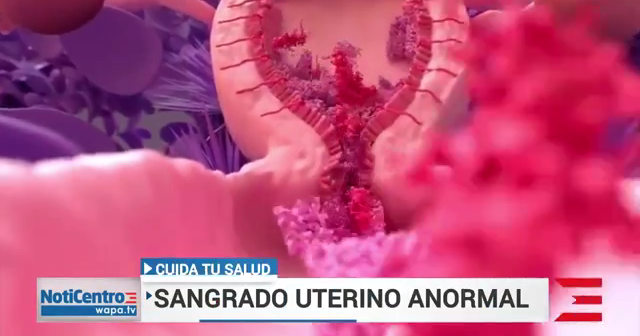 ¿Qué es el sangrado uterino anormal? | Salud | wapa.tv