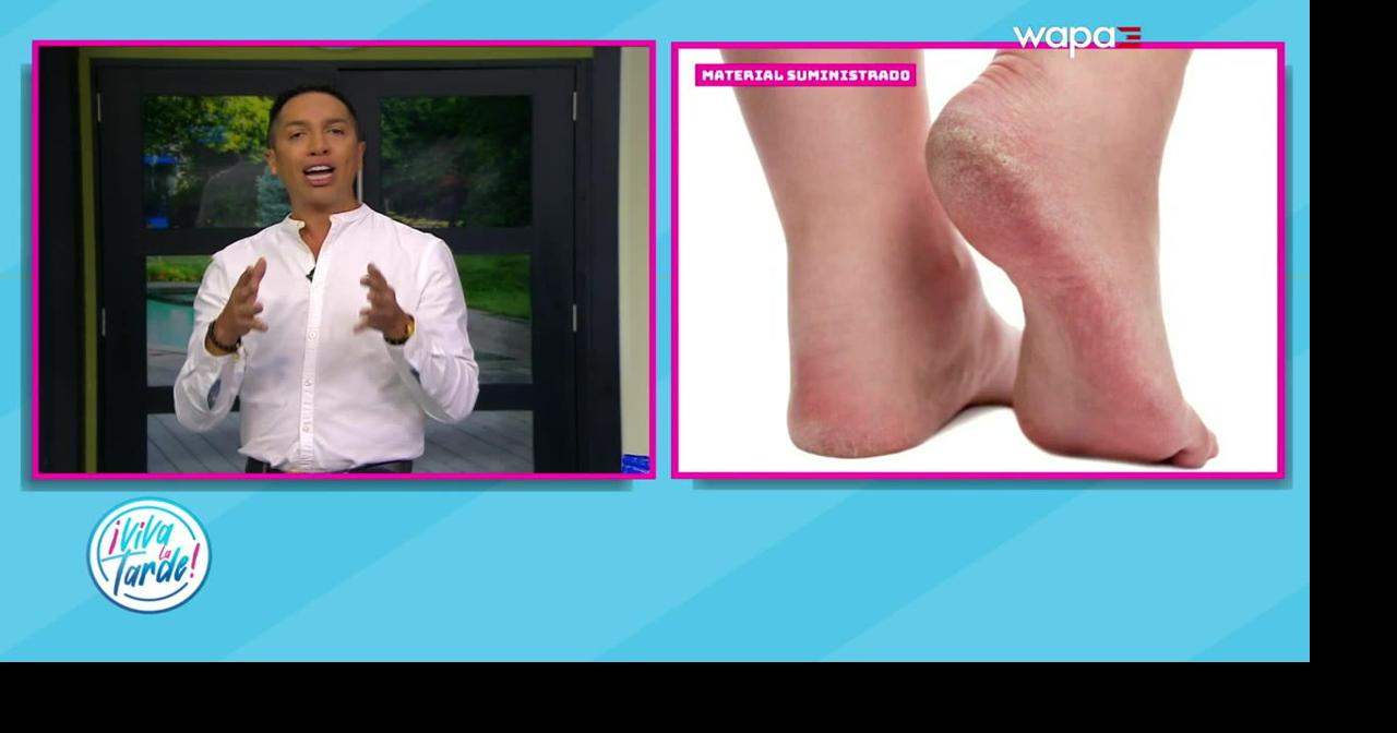 El Truco E' Bryan: Evita los talones cuarteados | Viva La Tarde | wapa.tv