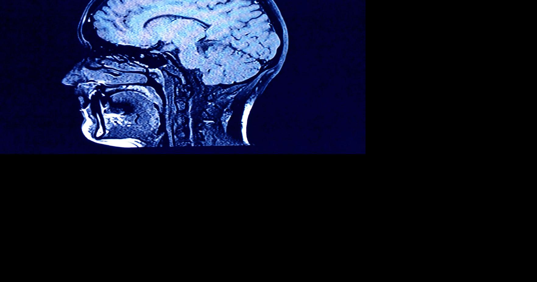 Get healthy: Make healthy aging a New Year’s resolution in 2026 | News ...