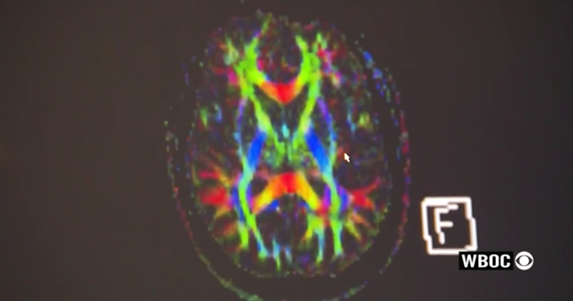 Early Visit To Concussion Specialist Can Make A Key Difference In Kids ...