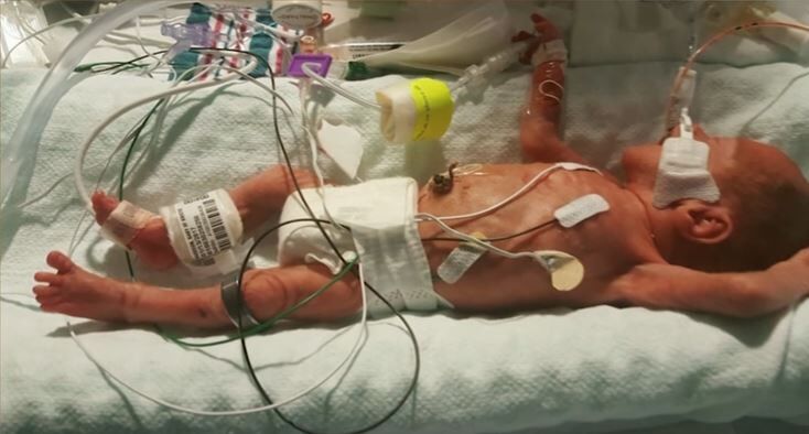 Community Supports Baby Merrick of Ocean View, Upcoming Fundraiser and ...