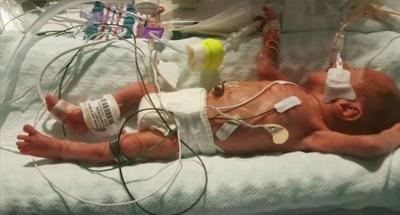 Community Supports Baby Merrick of Ocean View, Upcoming Fundraiser and ...