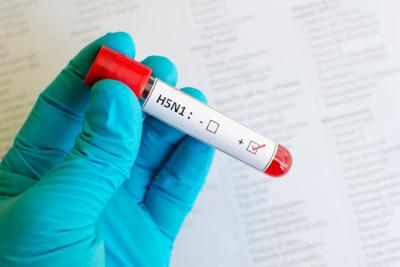 Highly Pathogenic Avian Influenza Confirmed in Md. Black Vultures ...