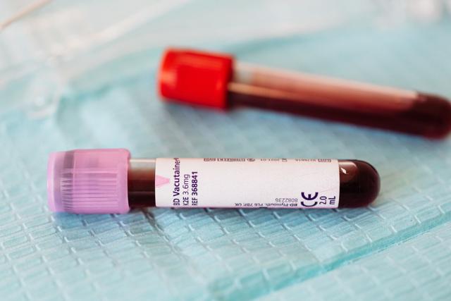 blood work- medical- labs-viles-blood | | wcn247.com