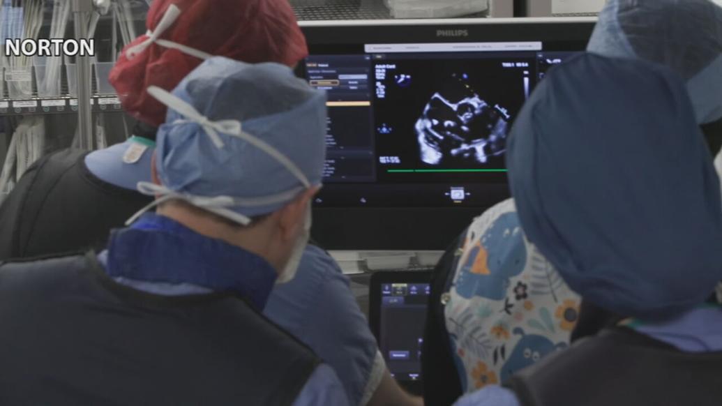 Norton Heart and Vascular specialists make history with first-of-its ...