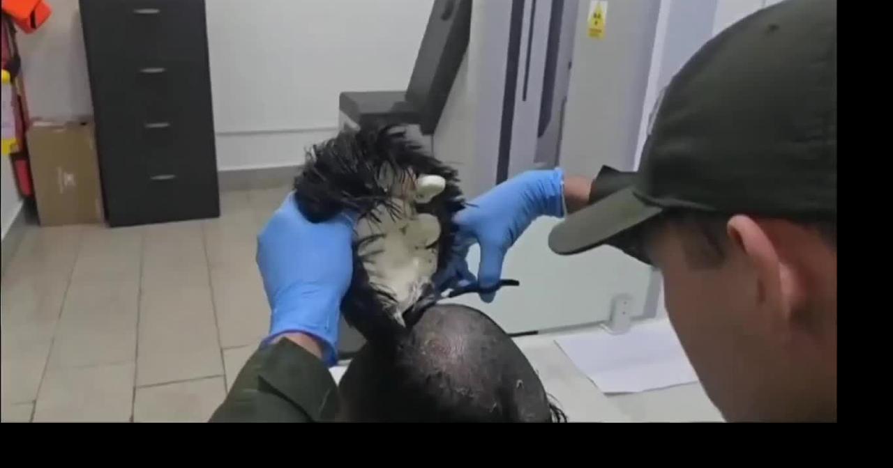 Colombian police catch man smuggling packets of cocaine under toupee | | wdrb.com