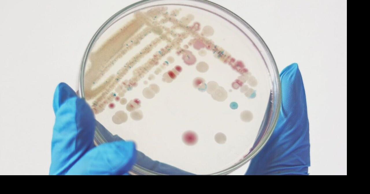 3 people killed in Connecticut and New York by rare flesh-eating ...