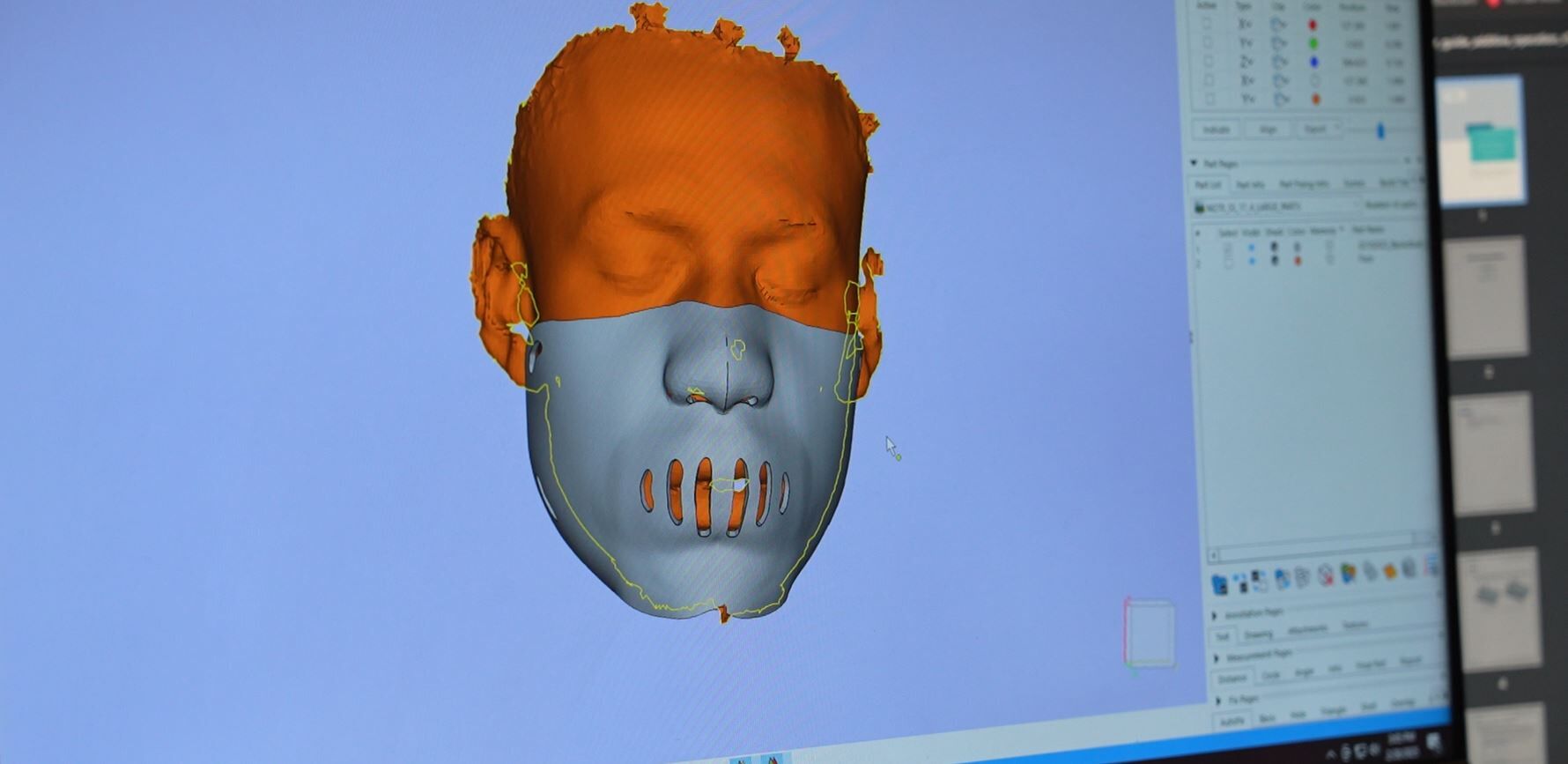 University of Louisville engineers save James Scott’s season with ...