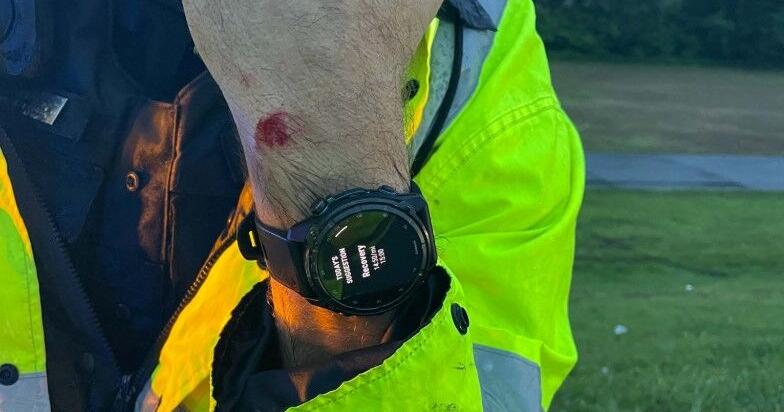 LMPD Detective Bryan Gillis' injuries from the Scottie Scheffler Arrest ...