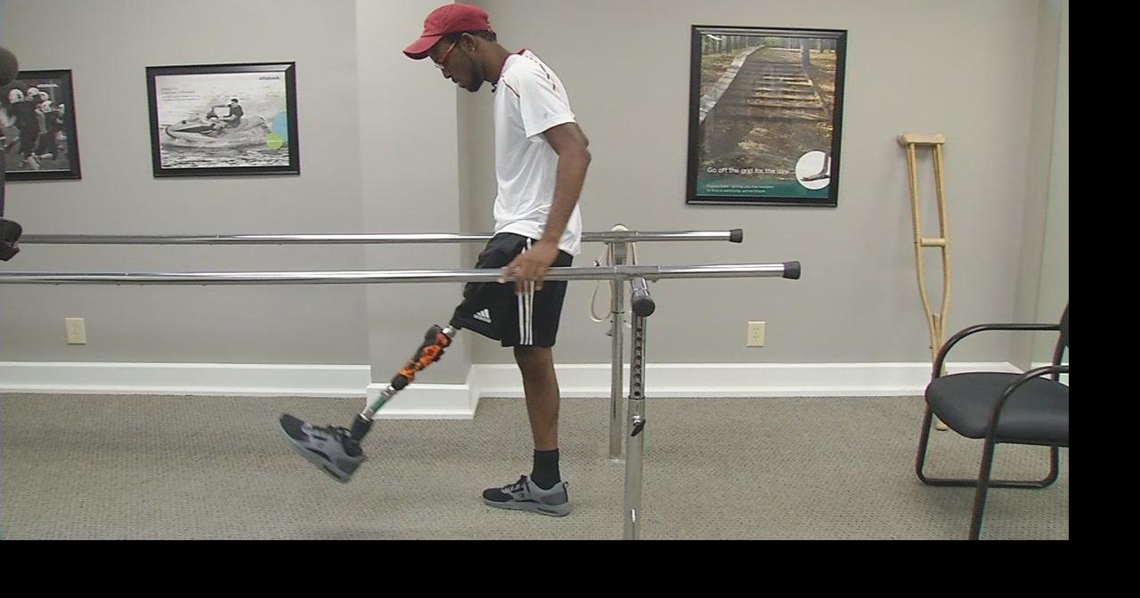 Special Olympics athlete from the Caribbean gets prosthetic leg in ...