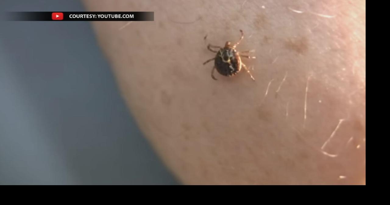 Doctors starting to see increase in tick bites in southern Indiana ...