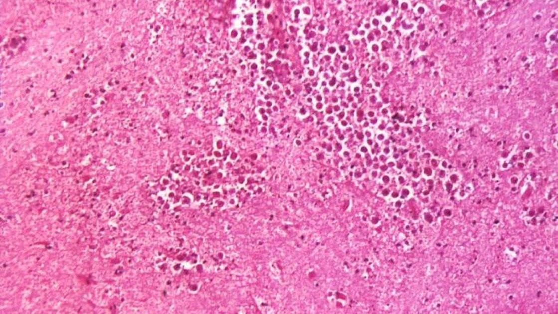 Naegleria fowleri.jpg | | wdrb.com