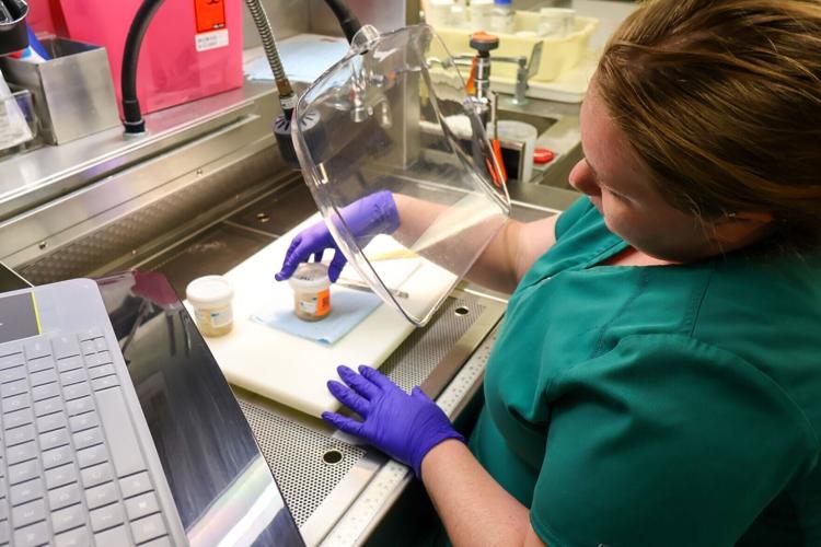 Inside the fight against ‘zombie deer disease,’ scientists confront ...