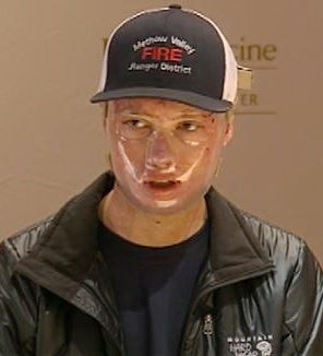 Burned firefighter Daniel Lyon released from Harborview | Local News ...