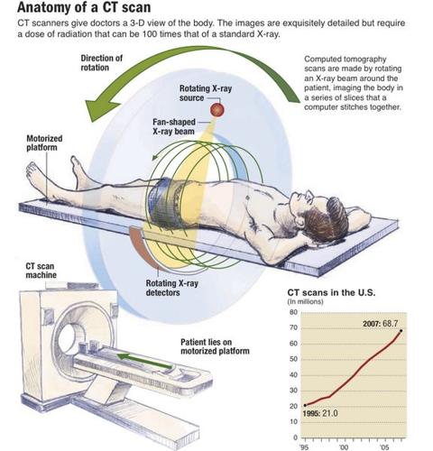 CT revolution has arrived, but at what price? | lifestyles ...