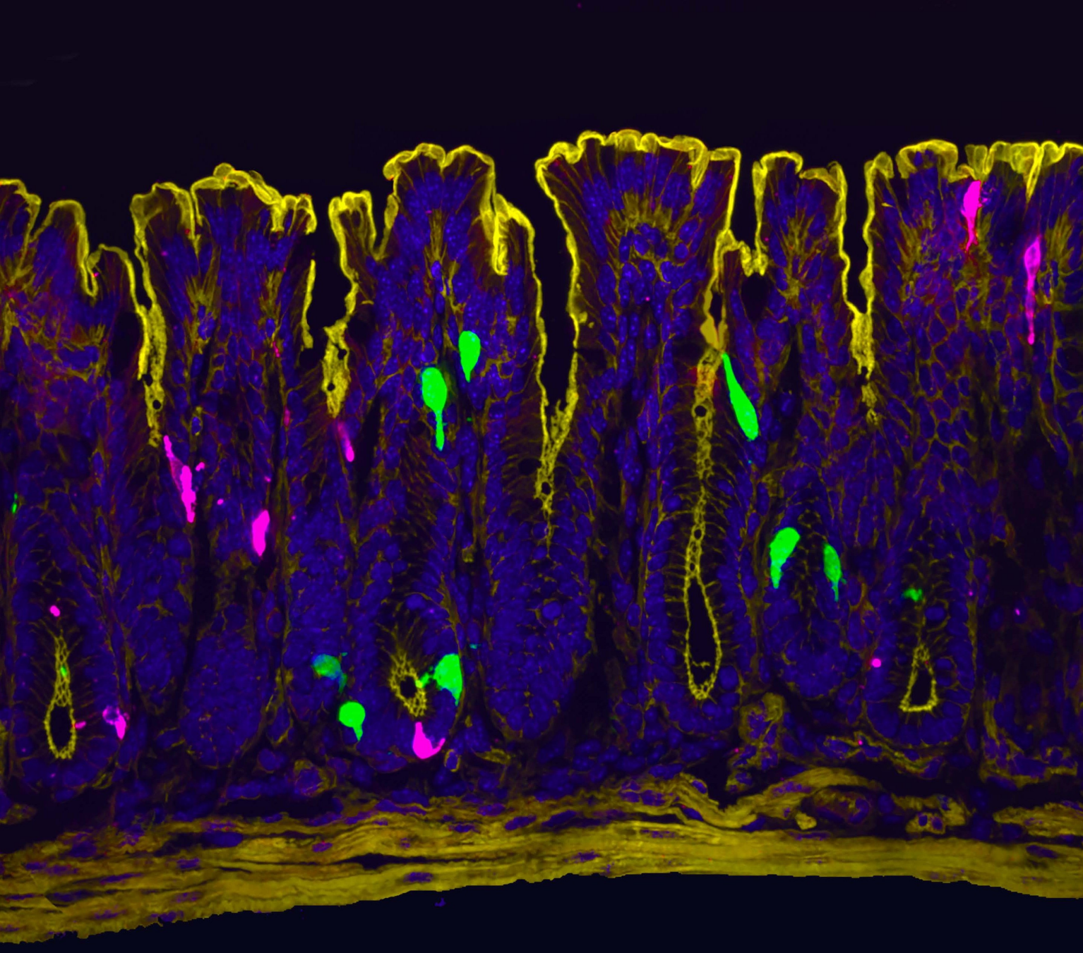Why women are more likely to suffer IBS pain | Health ...