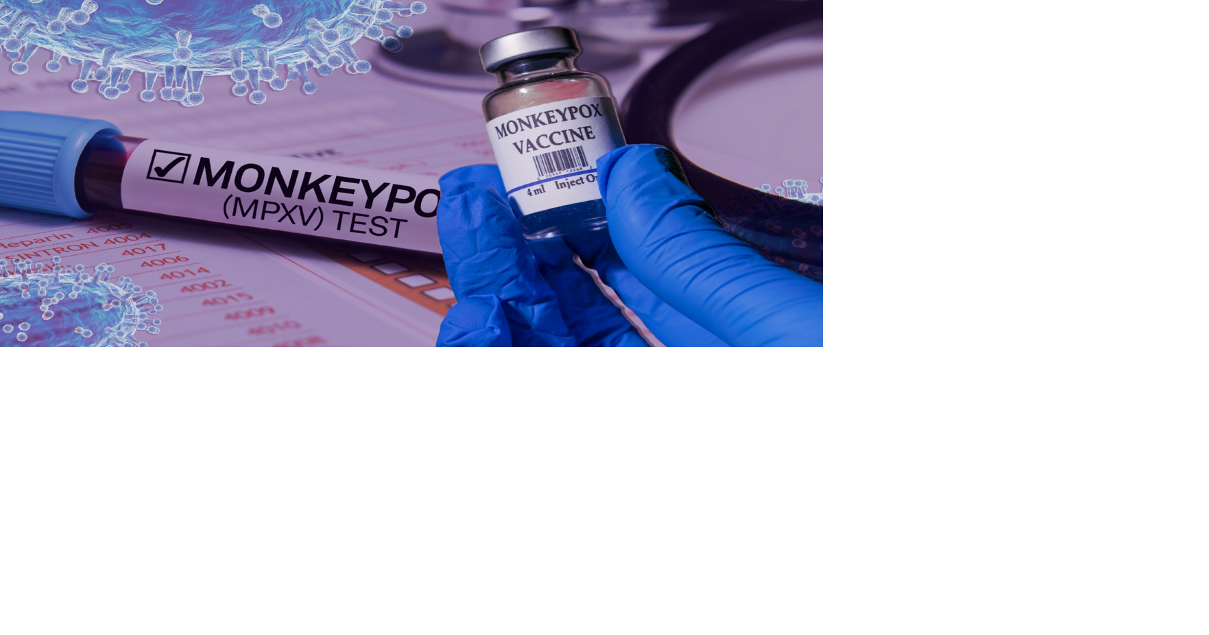 Do I need to be worried about monkeypox? | News | westerngazette.ca