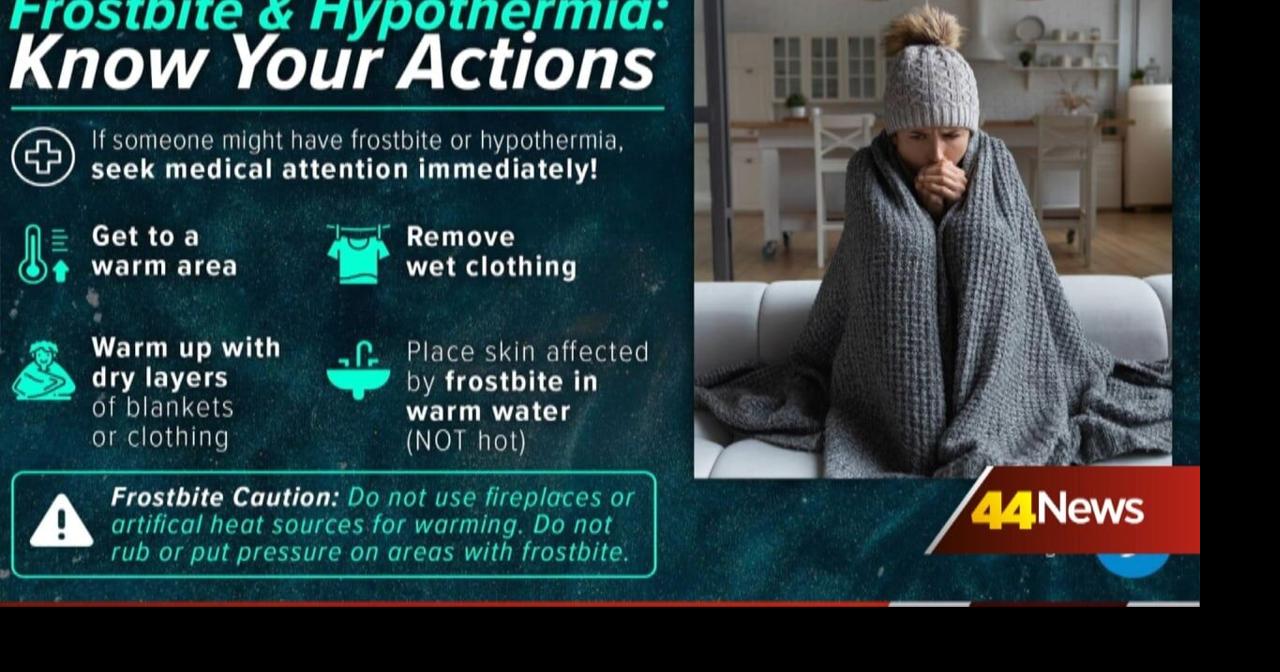 Know the difference between frostbite and hypothermia | Video | wevv.com