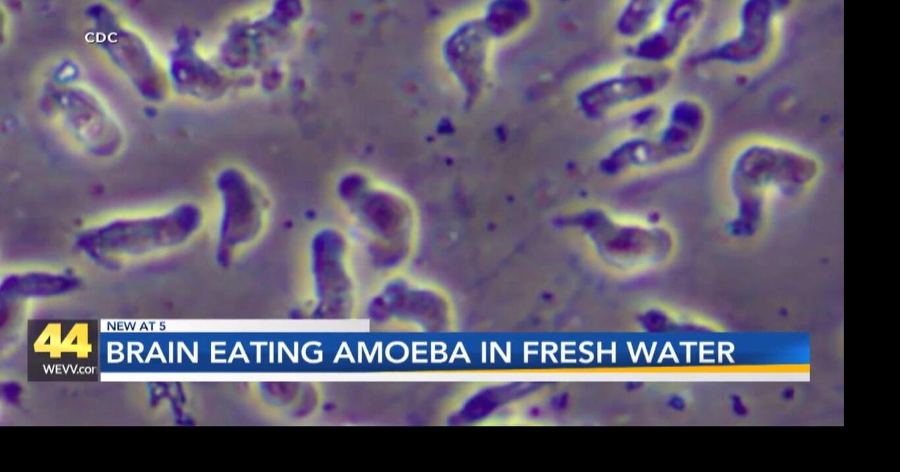 Brain eating amoeba move into Indiana | Health | wevv.com