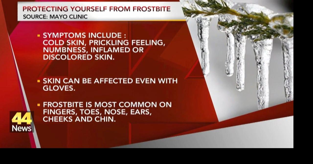 Preventing Frostbite: What you need to do | News | wevv.com