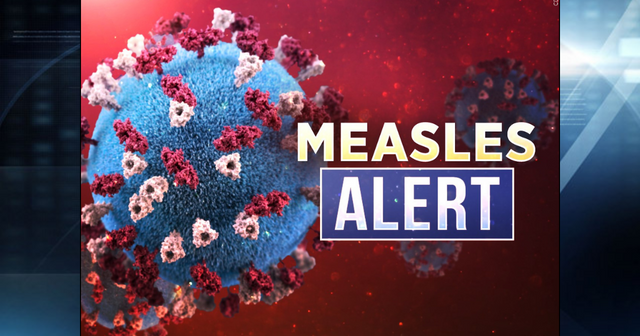Indiana Department of Health confirms first case of measles in five ...